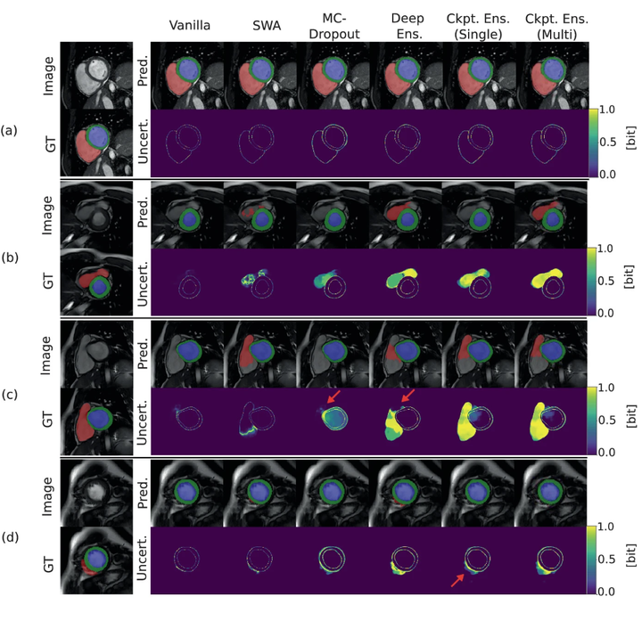 Efficient Bayesian Uncertainty Estimation for nnU-Net | Process Intelligence Research Group